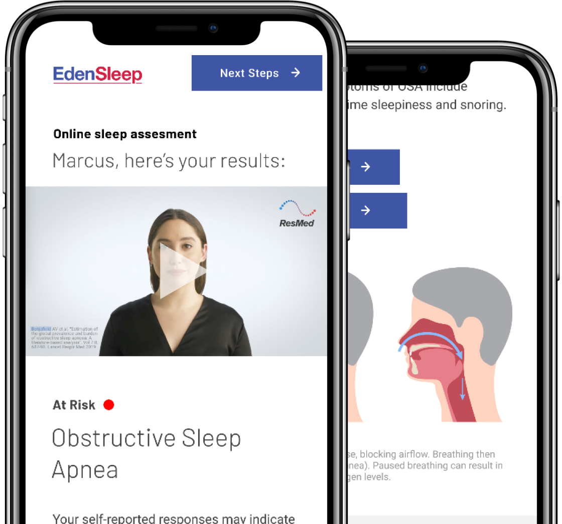 Online Sleep Assessment | EdenSleep